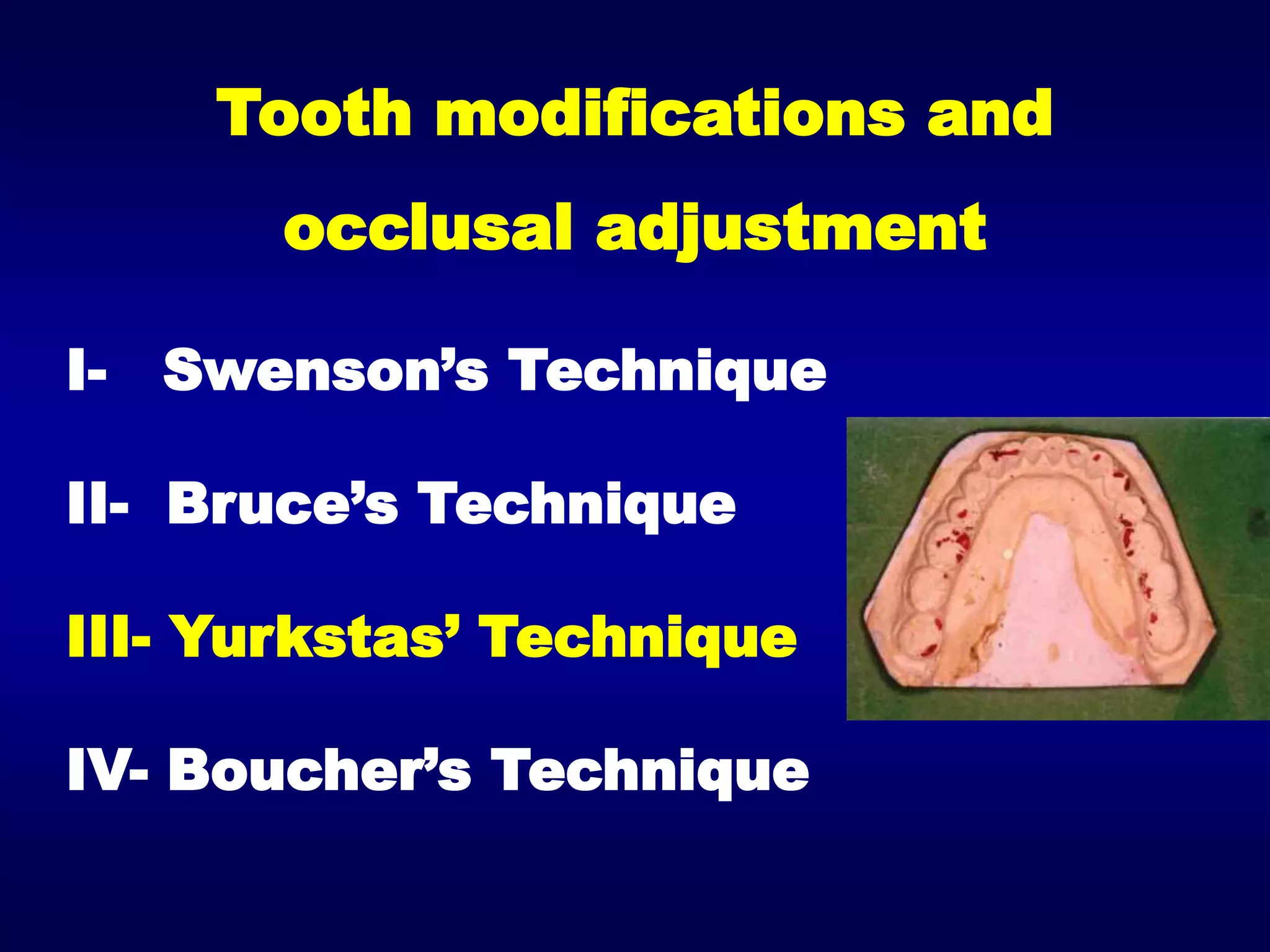 Occlusion of single denture (Management of Maxillary and Mandibular ...