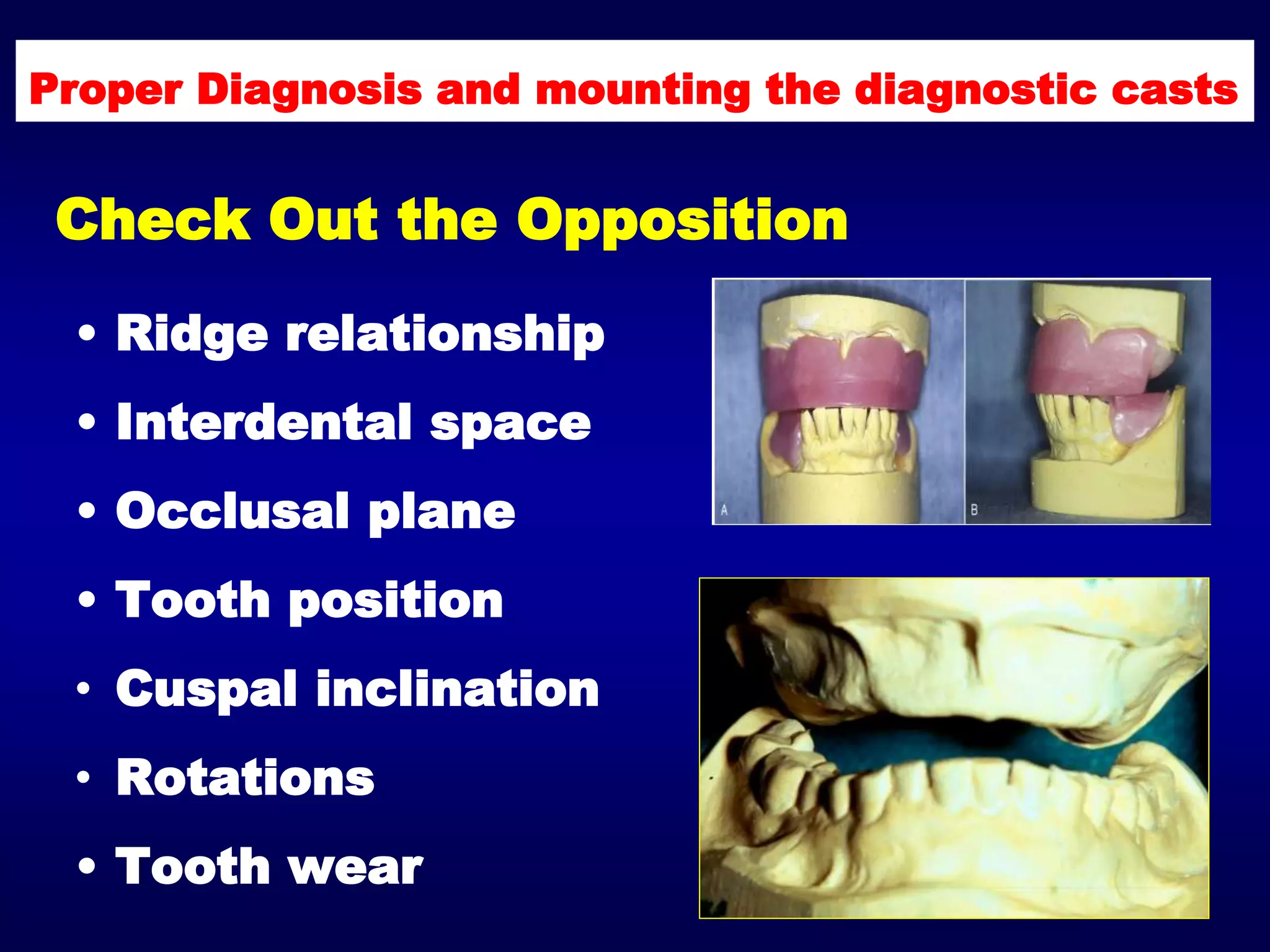 Occlusion of single denture (Management of Maxillary and Mandibular ...