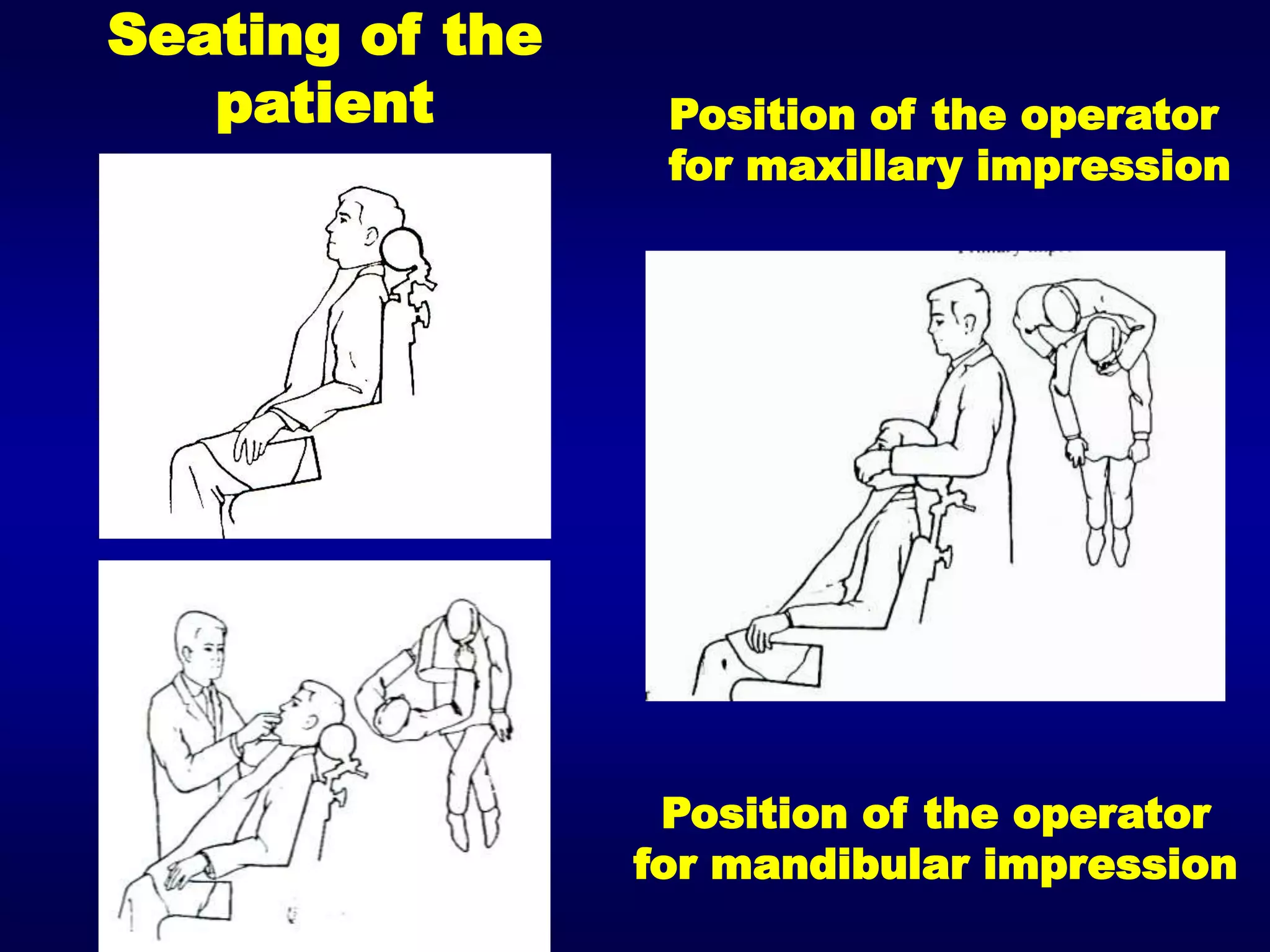 Occlusion of single denture (Management of Maxillary and Mandibular ...