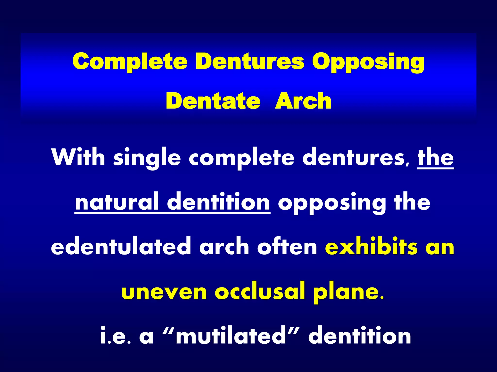Occlusion of single denture (Management of Maxillary and Mandibular ...