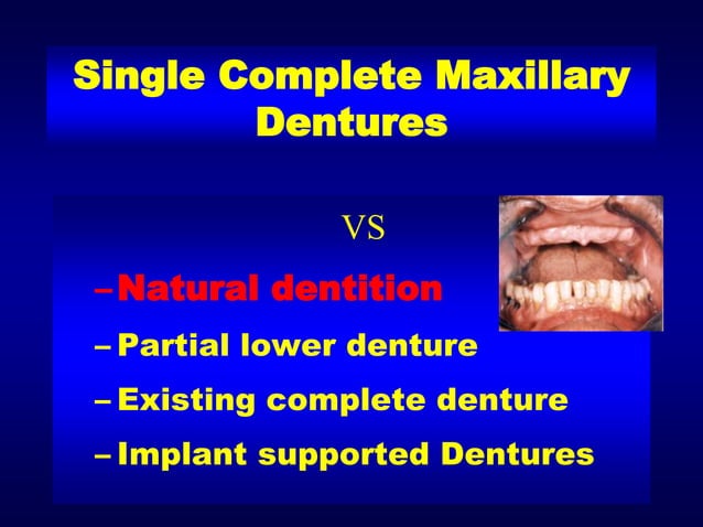 Occlusion of single denture (Management of Maxillary and Mandibular ...