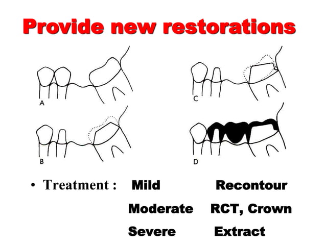 Occlusion of single denture (Management of Maxillary and Mandibular ...