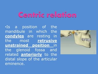 ]Dental Occlusion part 1 | PPTX