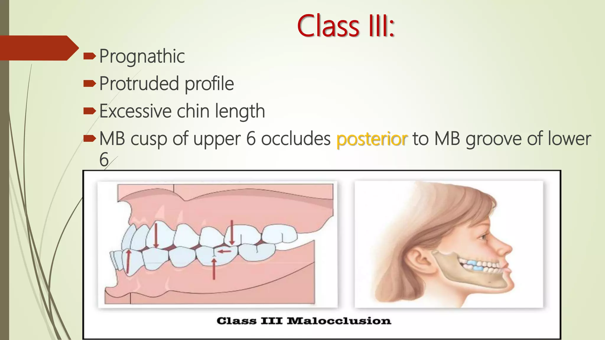 Occlusion part 2 final | PPTX