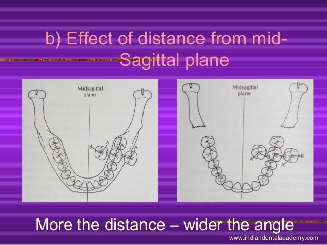 Occlusion part/ orthodontic continuing education