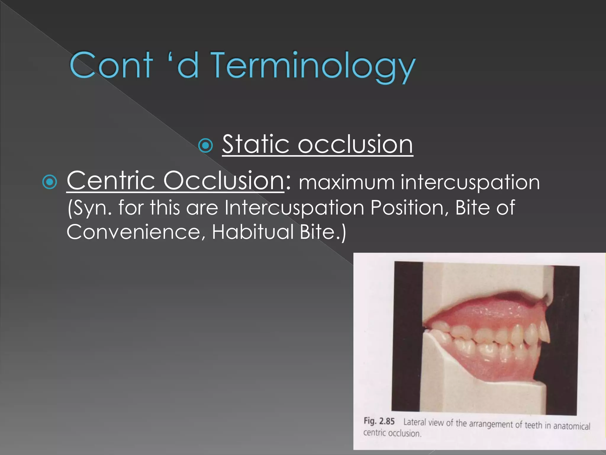 Occlusion presentation | PPTX