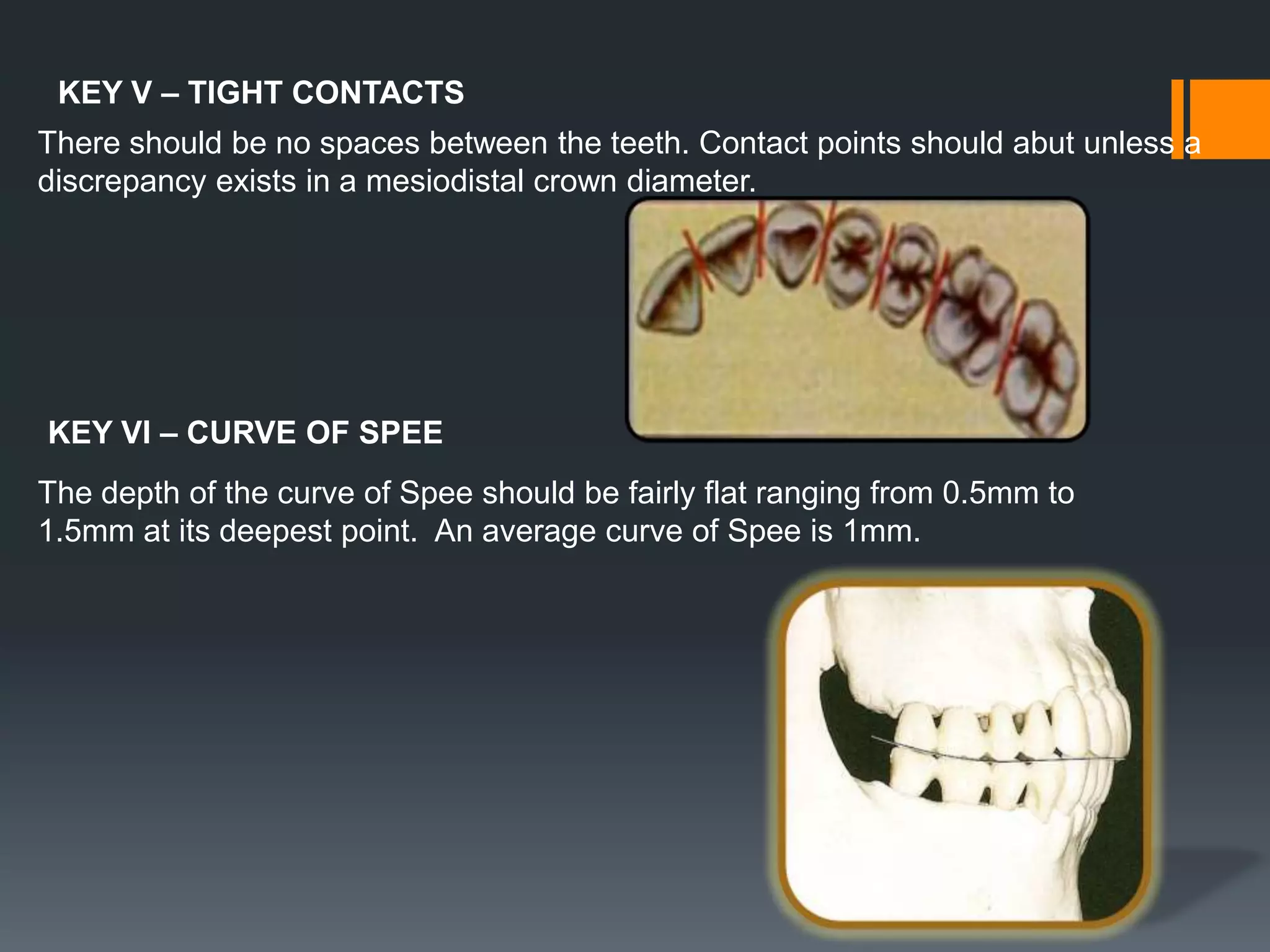 OCCLUSION IN COMPLETE DENTURES | PPTX