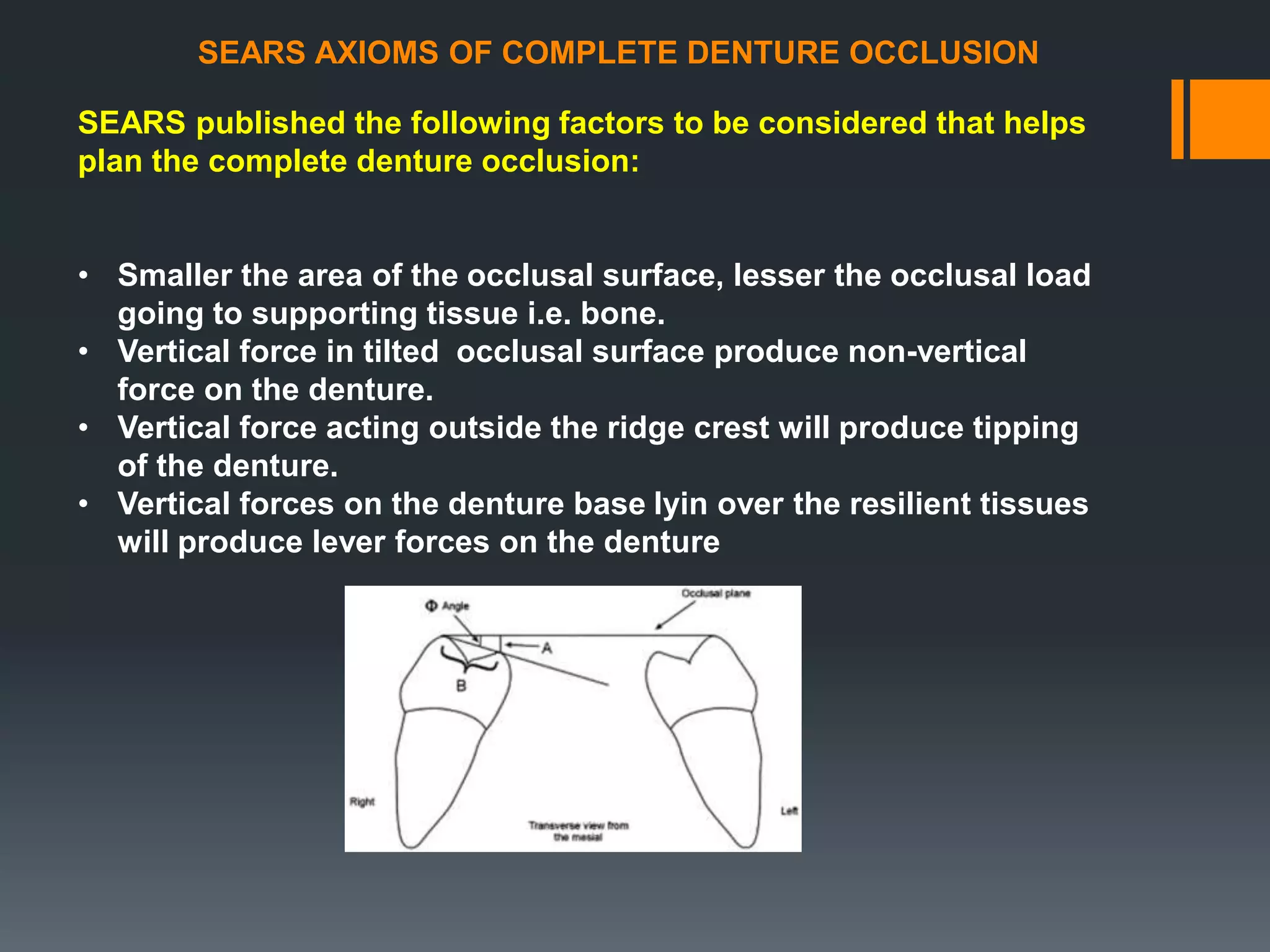 OCCLUSION IN COMPLETE DENTURES | PPTX | Dental Health | Diseases and ...