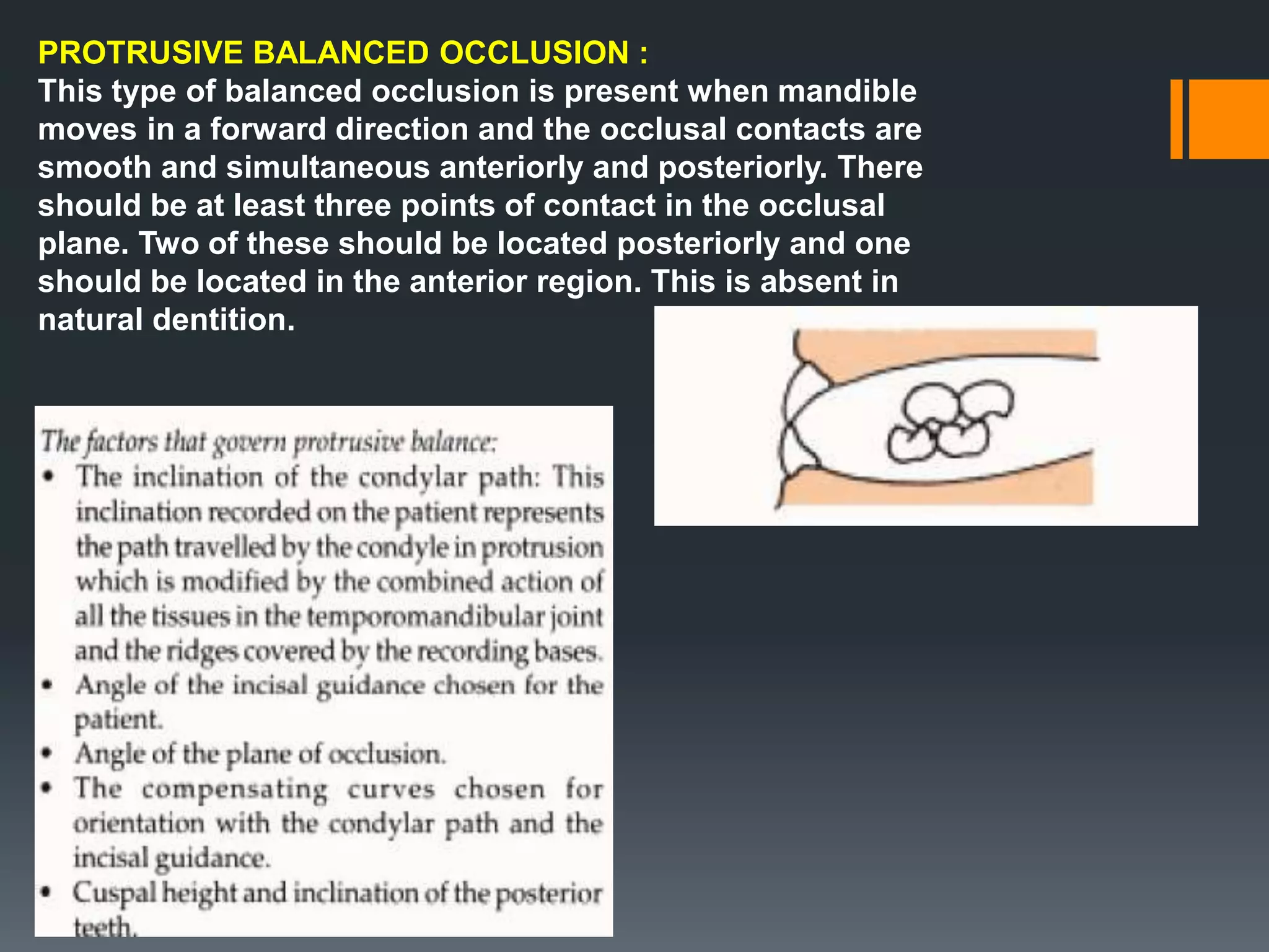 OCCLUSION IN COMPLETE DENTURES | PPTX