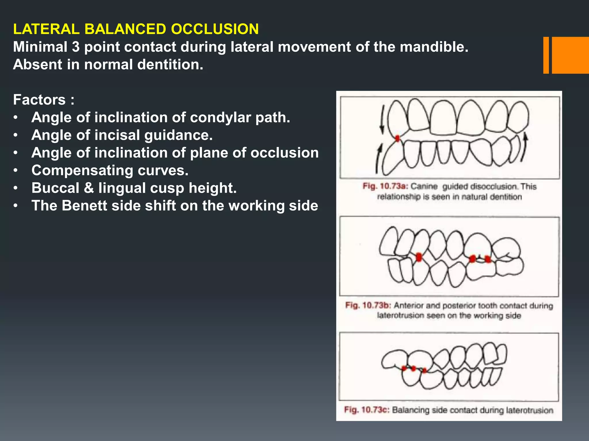 OCCLUSION IN COMPLETE DENTURES | PPTX