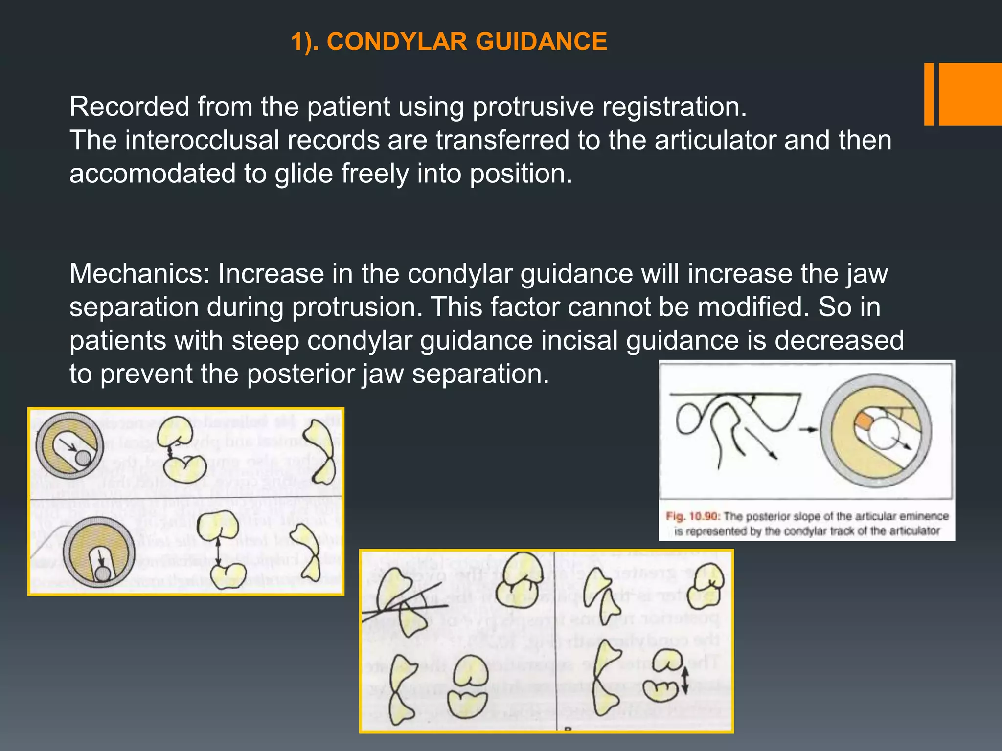 OCCLUSION IN COMPLETE DENTURES | PPTX