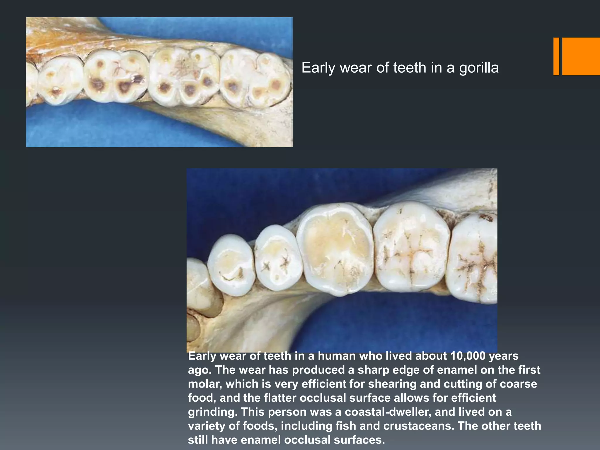 OCCLUSION IN COMPLETE DENTURES | PPTX