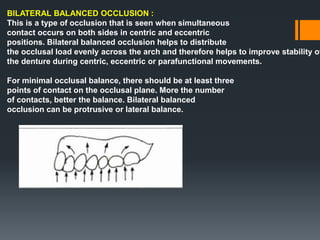 OCCLUSION IN COMPLETE DENTURES | PPTX
