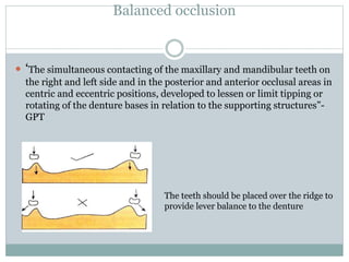 Occlusion | PPT