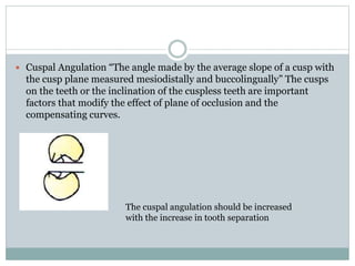 Occlusion | PPT