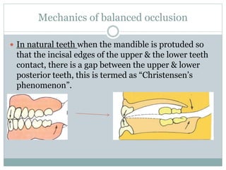 Occlusion | PPTX