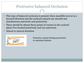 Occlusion | PPT