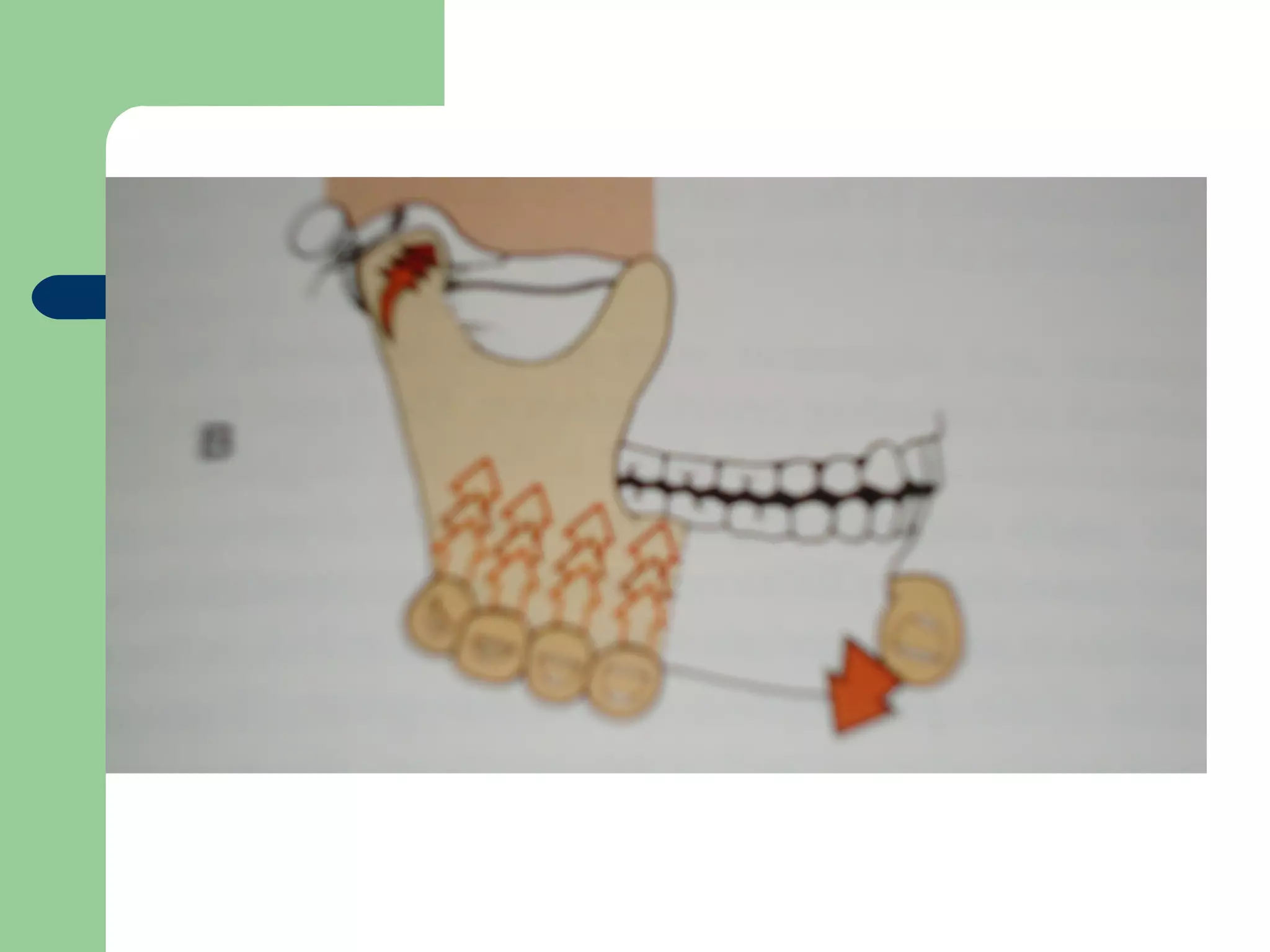 Occluso muscle disorder | PPT