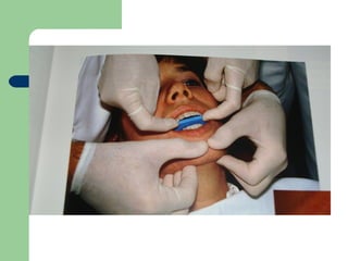 Occluso muscle disorder | PPT