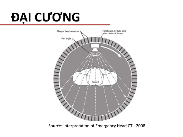Đọc CLVT sọ não chấn thương - Brain CT-Vietnamese version_new.pptx