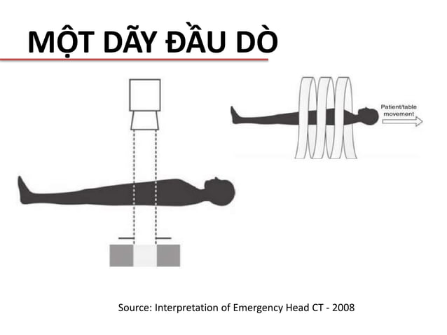 Đọc CLVT sọ não chấn thương - Brain CT-Vietnamese version_new.pptx