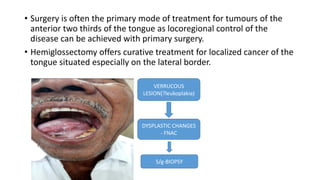 ORAL CAVITY CANCER RESECTIONS:MANDIBULECTOMY & GLOSSECTOMY | PDF