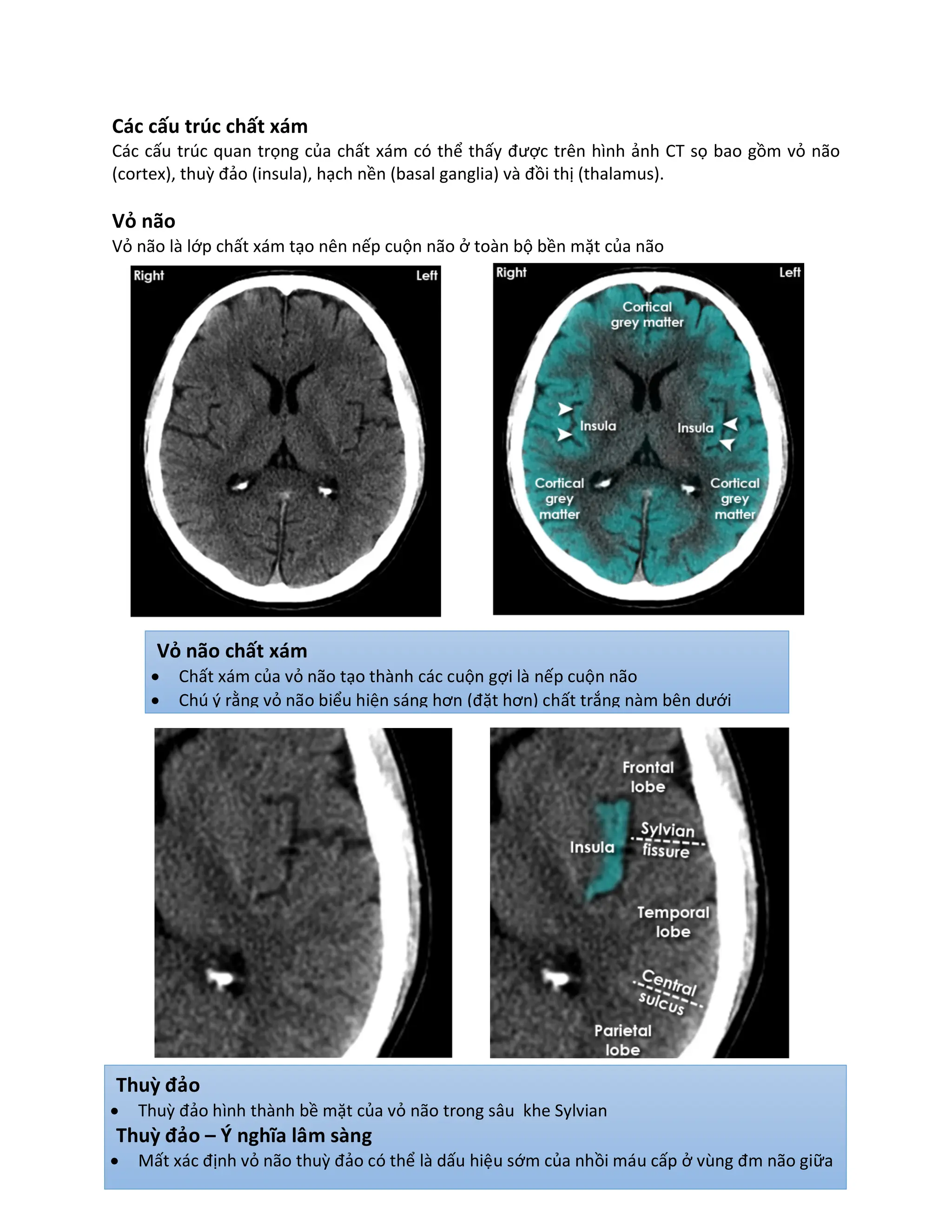 ĐỌC CT SỌ CƠ BẢN đại học y dược Huế.pdf