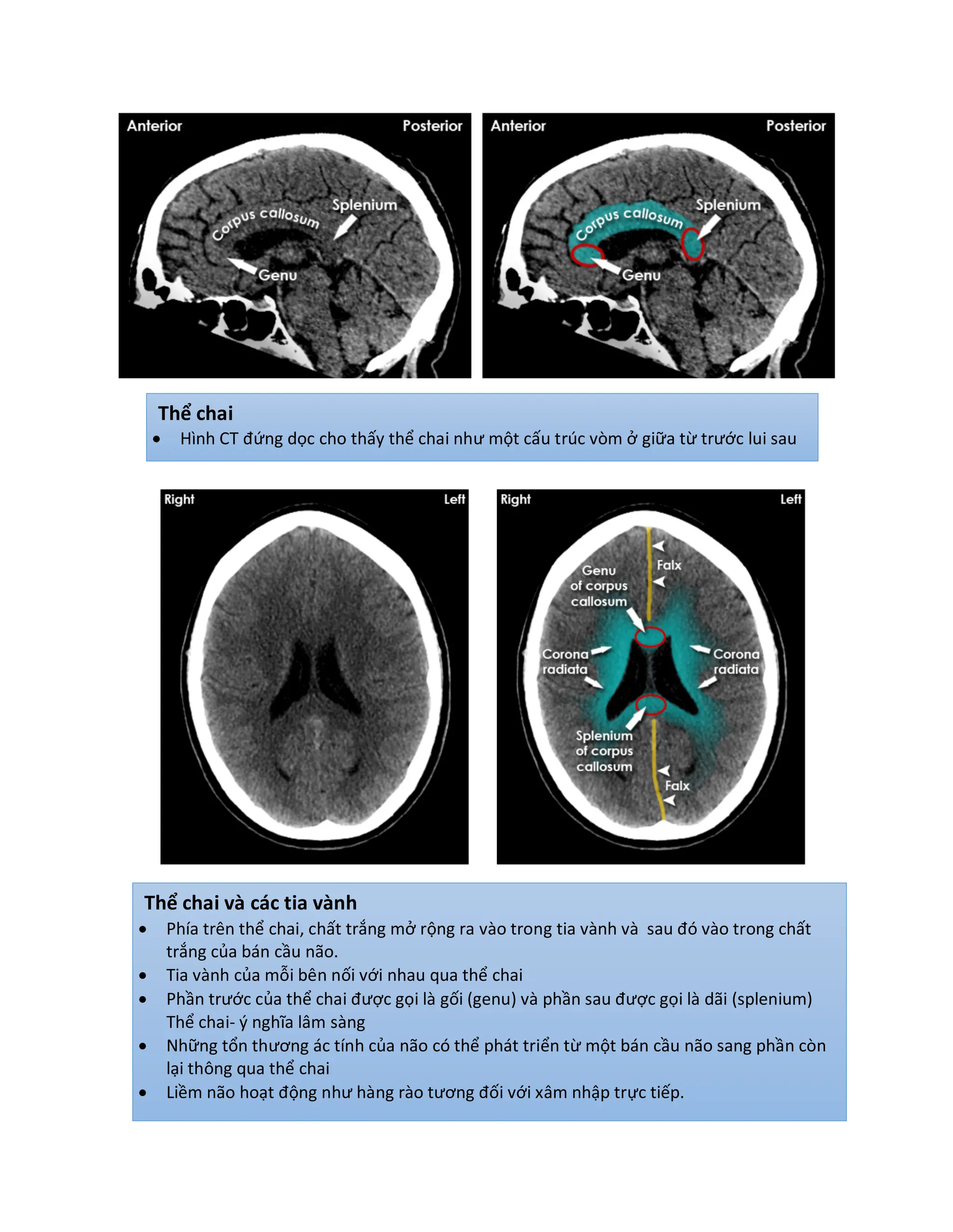 ĐỌC CT SỌ CƠ BẢN đại học y dược Huế.pdf