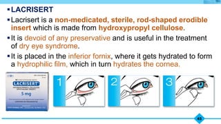 OCCULAR DRUG DELIVERY SYSTEM | PDF