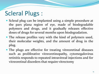 Occular Drug Delivery System | PPT