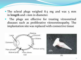 Occular Drug Delivery System | PPT