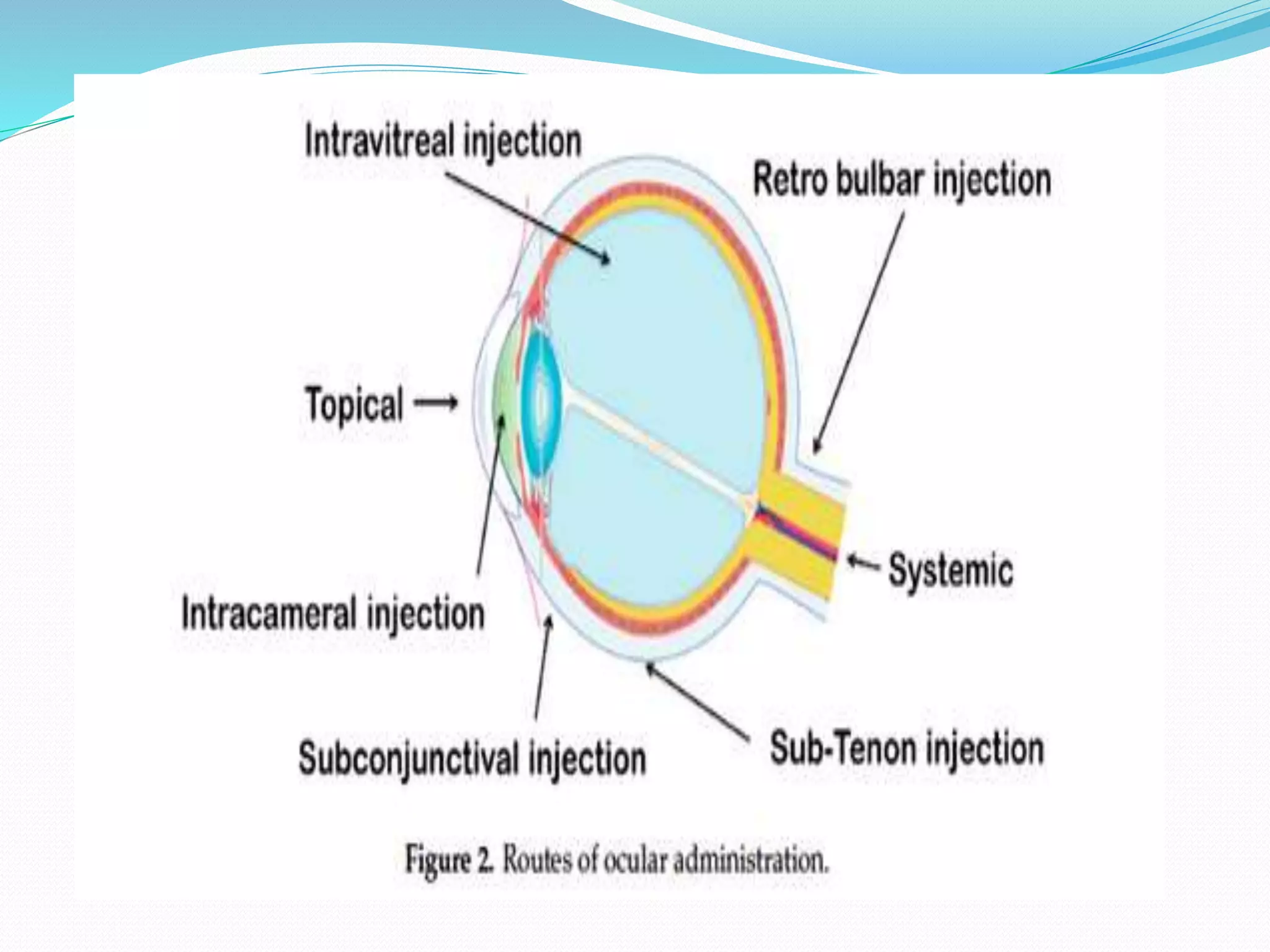 Occular drug delivery system ppt | PPTX