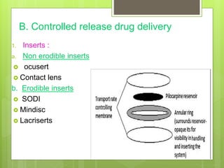 Occular Drug Delivery Systems.pptx