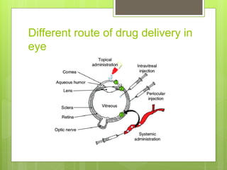 Occular Drug Delivery Systems.pptx