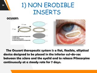 Occular drug delivery sytem | PPT