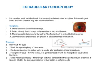 Occular Emergencies by Dr khalid .pdf