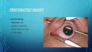 Ocular emergency or eye emergency | PPT