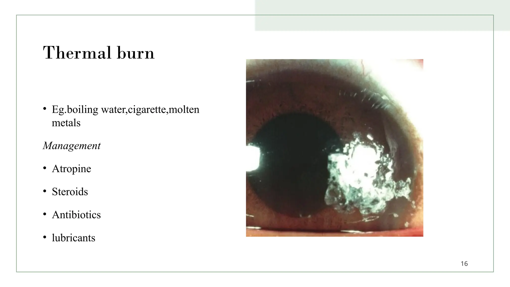 OCCULAR INJURIES ,TYPES AND ITS MANAGEMENT | PPT