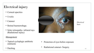 OCCULAR INJURIES ,TYPES AND ITS MANAGEMENT | PPT