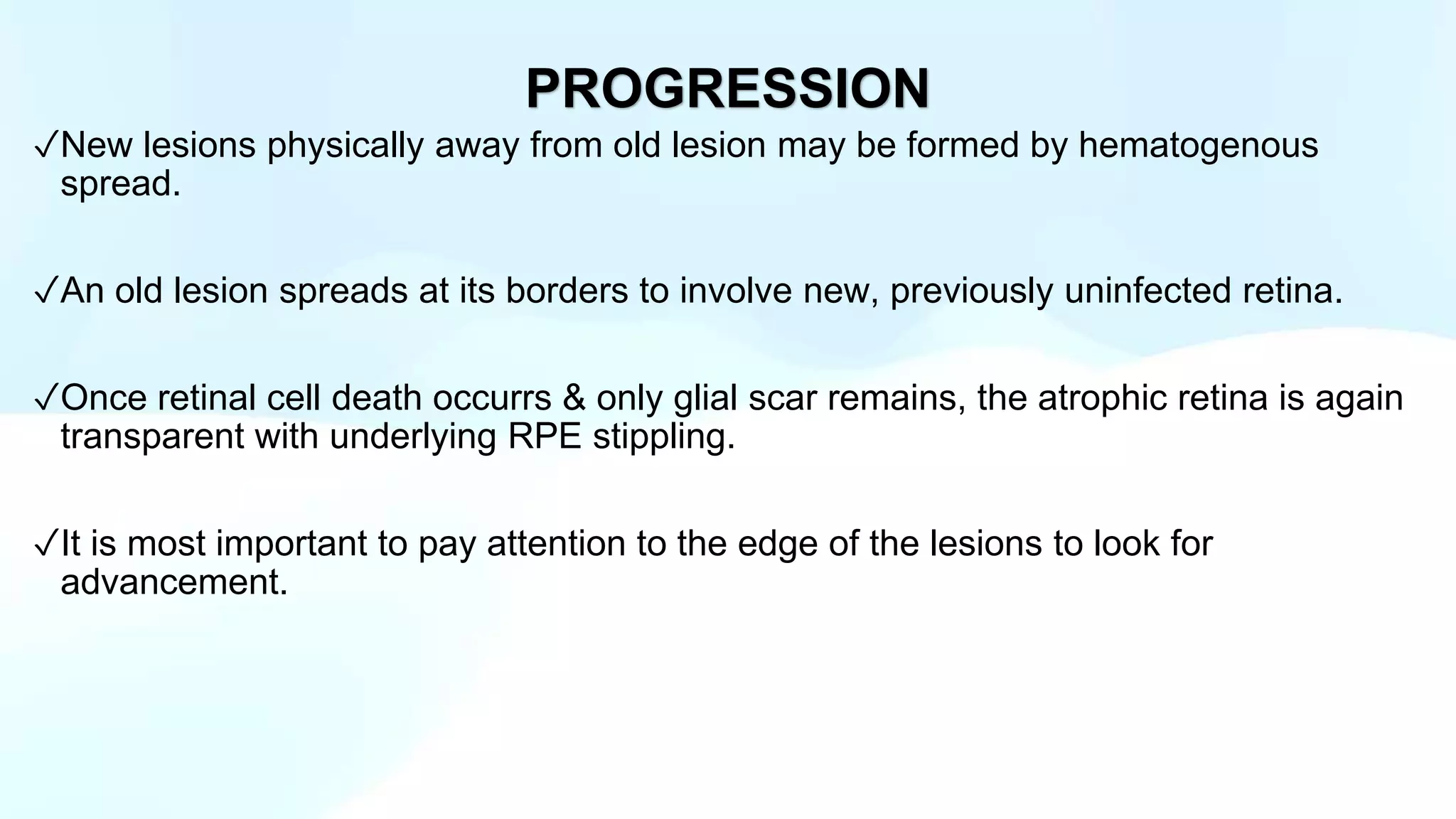 Occular manifestations in HIV AIDS .pptx