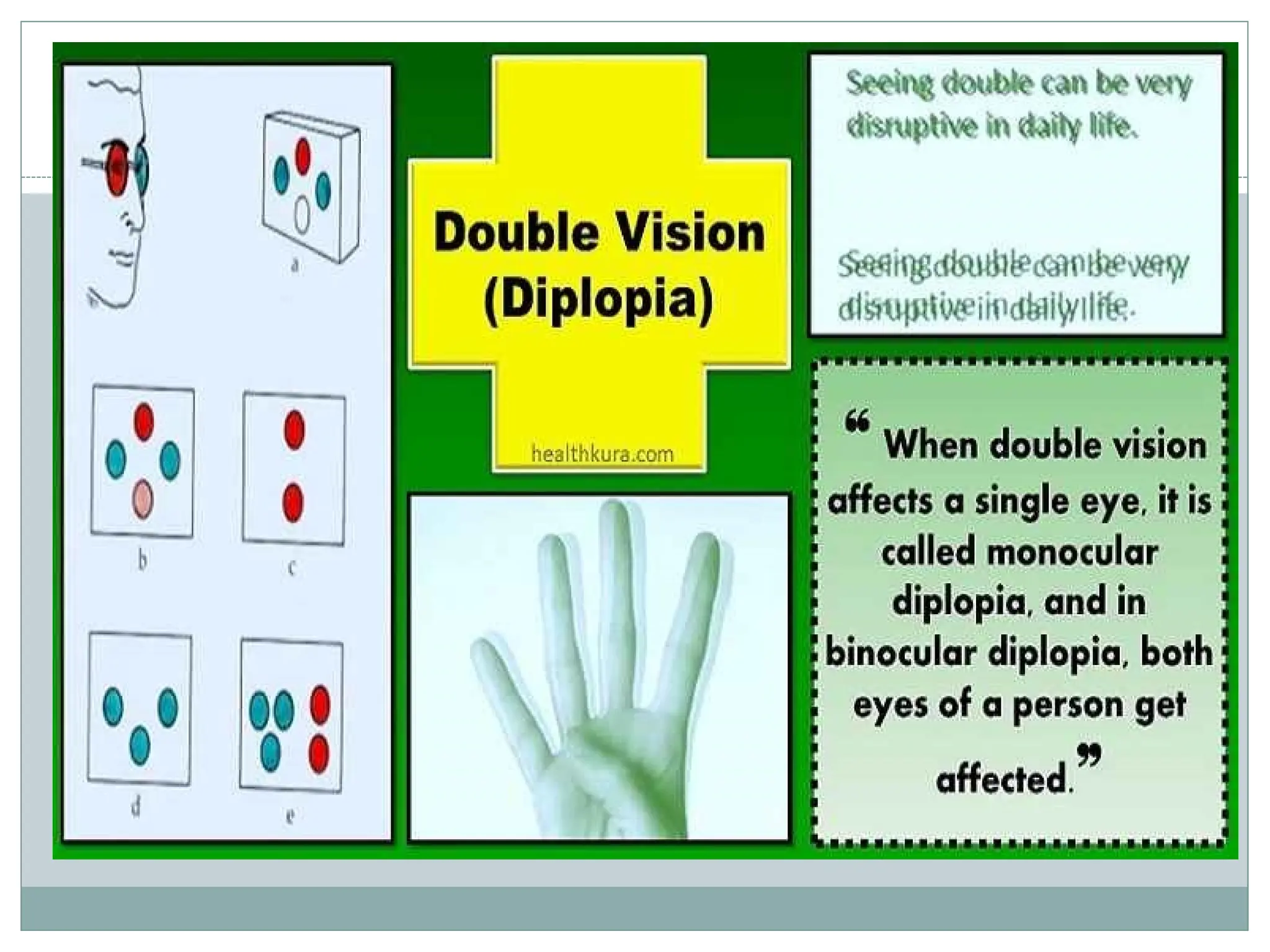 Occulomotor ,Trochlear and Abducens Nerve.pptx
