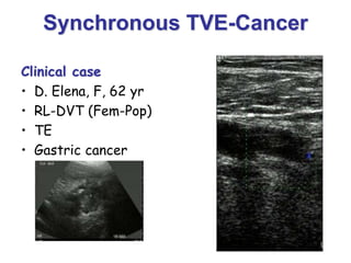 Occult cancer screening in thromboembolic disease | PPT