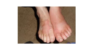 occup-therma-effects.pptx