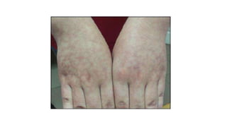 occup-therma-effects.pptx