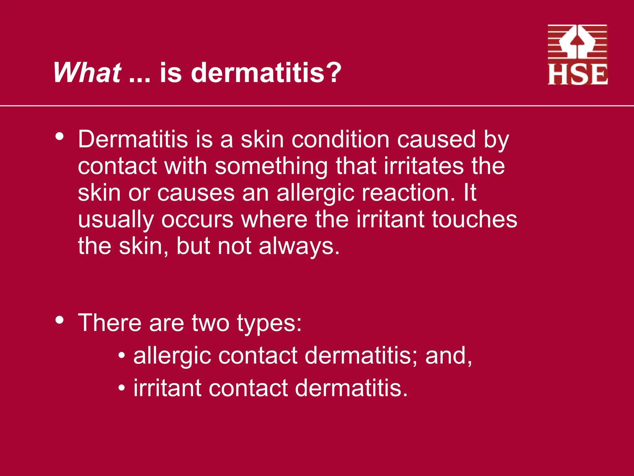 occupational-dermatitis-what.ppt