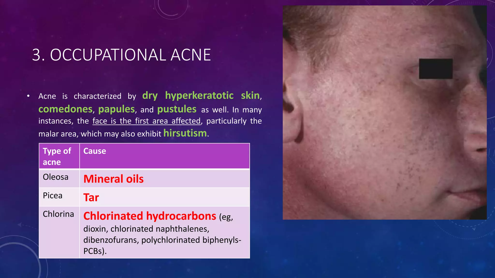 Occupational_dermatoses.ppt
