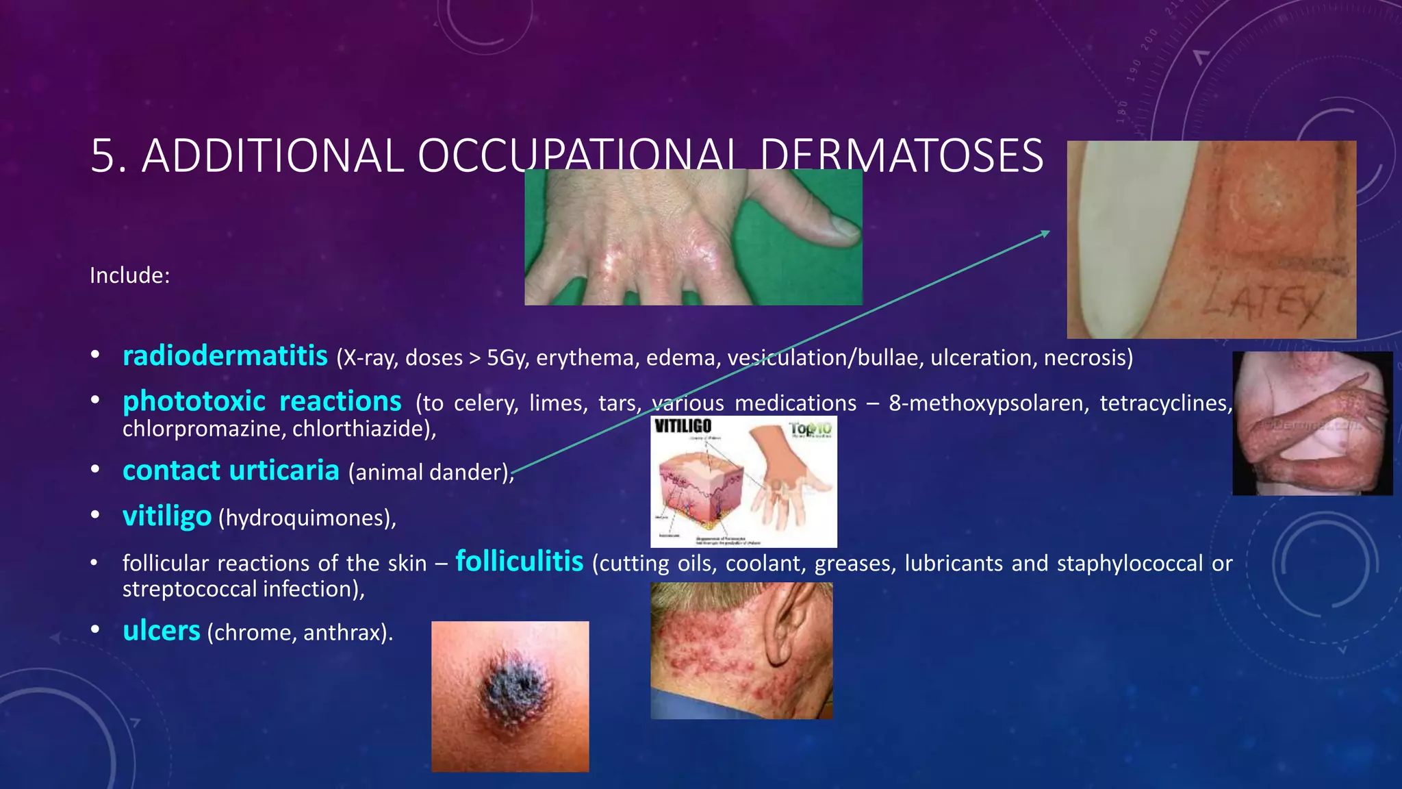Occupational_dermatoses.ppt