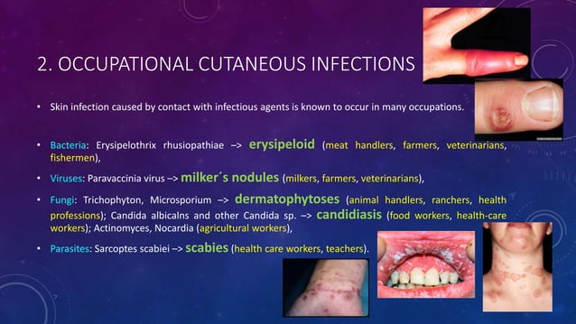 Occupational_dermatoses.ppt