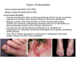 Occupational diseases | PDF