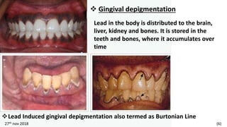 Occupational hazards | PPT